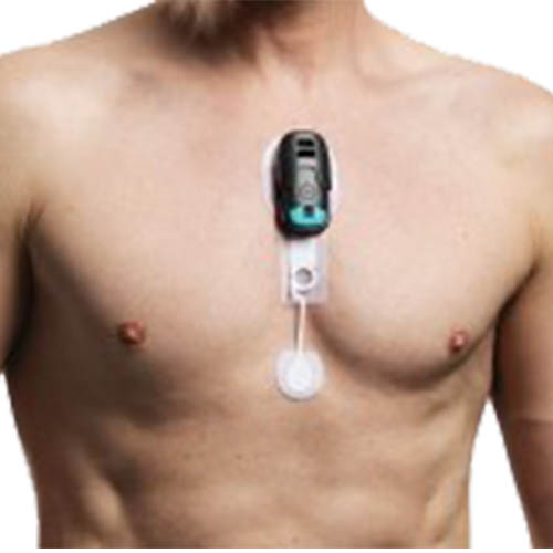Holter Test in Ghaziabad, Noida, Faridabad, Gurugram, Greater Noida